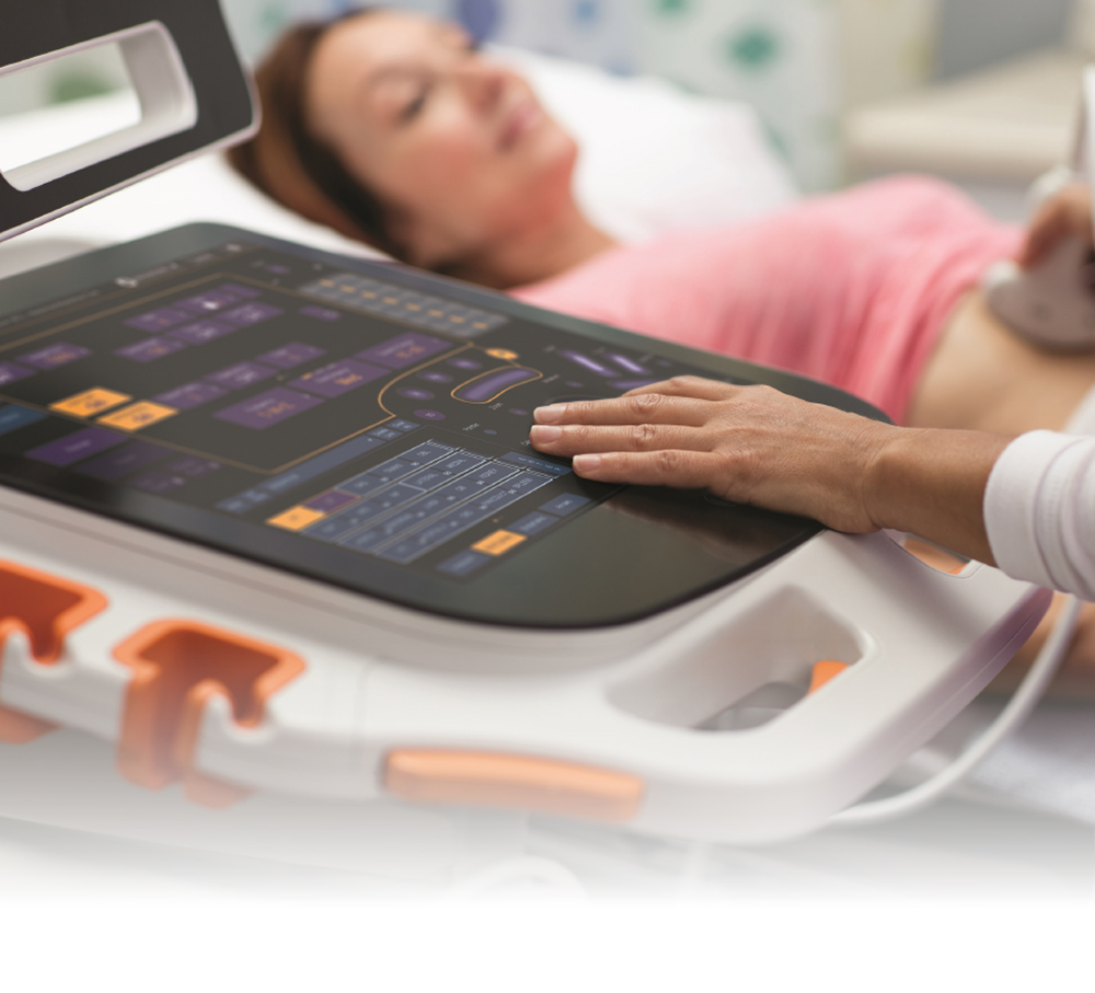 Carestream Touch Ultrasound Systems - ICE