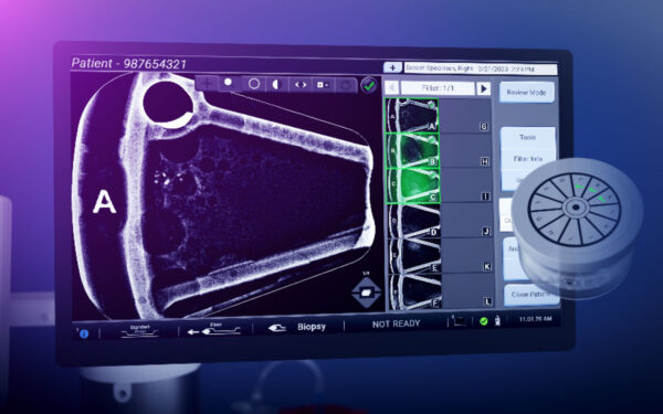 Hologic Brevera Breast Biopsy System - ICE