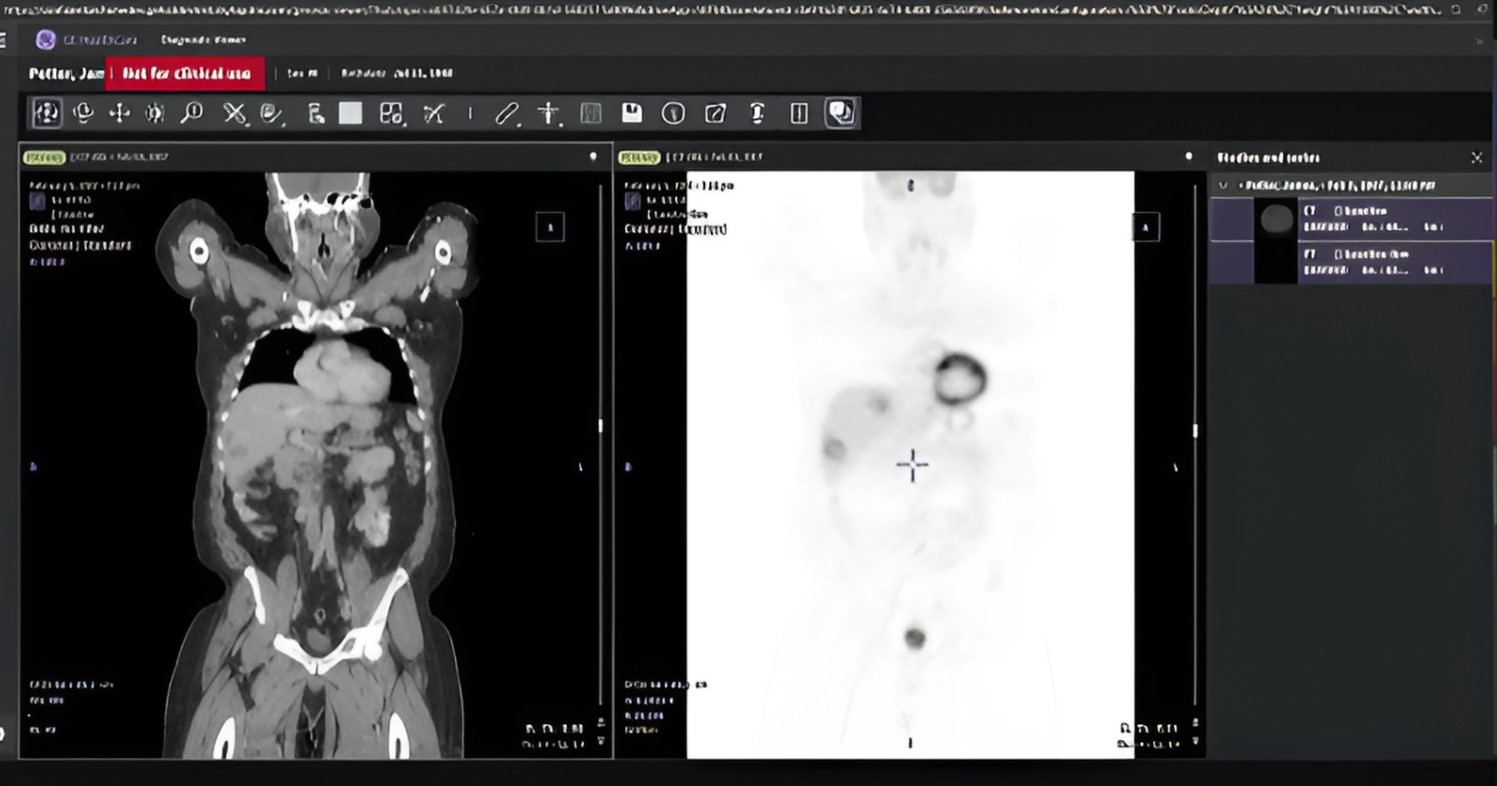 GE HealthCare Expands Access to Cloud-Enabled Enterprise Imaging ...