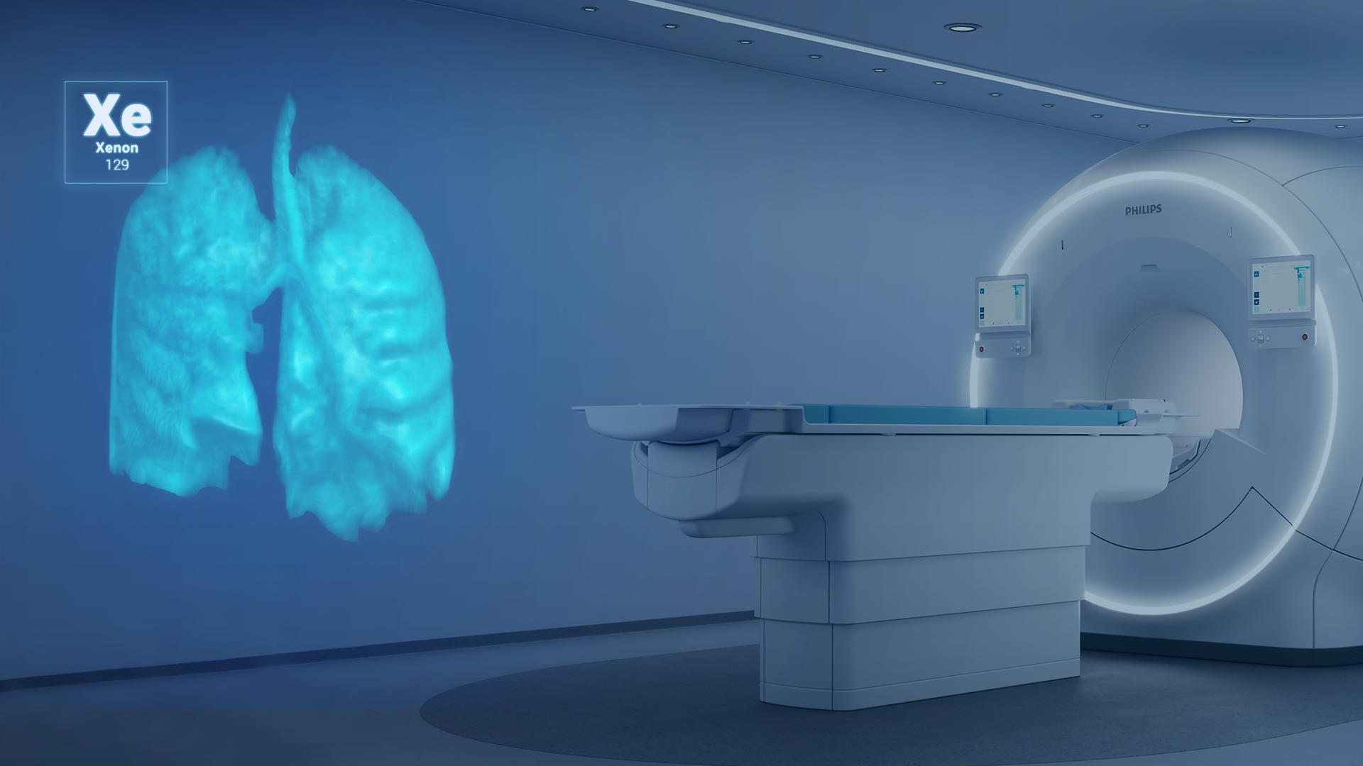 Study Demonstrates Xenon MRI Predicts Cystic Fibrosis Exacerbations - ICE